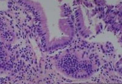 Human Multi-tissue Tissue MicroArray (Normal) from Novus Biologicals ...