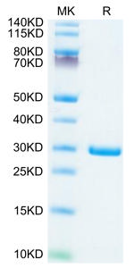 SARS-COV-2 NSP7&NSP8 Protein (NSP-VE178) from Kactusbio Inc. | Biocompare.com